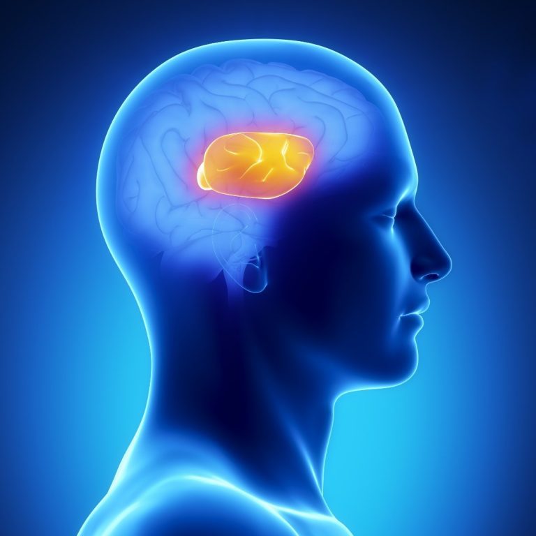 Corpus Callosotomy | Split Brain Surgery | NSPC