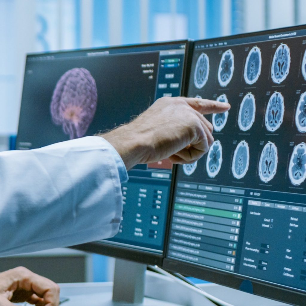 Deep Brain Stimulation Surgery | NSPC Brain & Spine Surgery