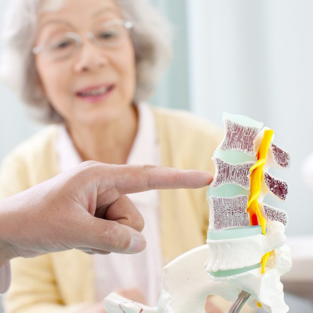 Dorsal Column Stimulation | NSPC Brain & Spine Surgery