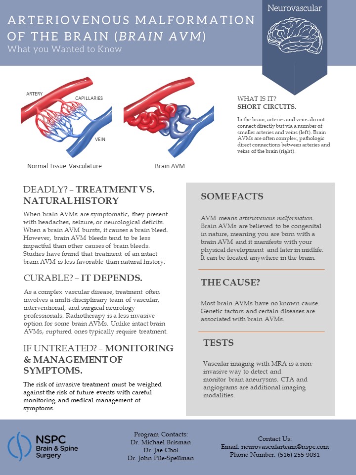 Brain Avm Arteriovenous Malformation Symptoms And Human And Mouse